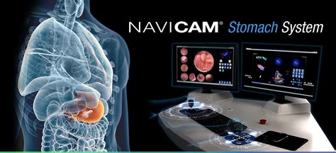 NaviCam® Stomach System - AnX Robotics