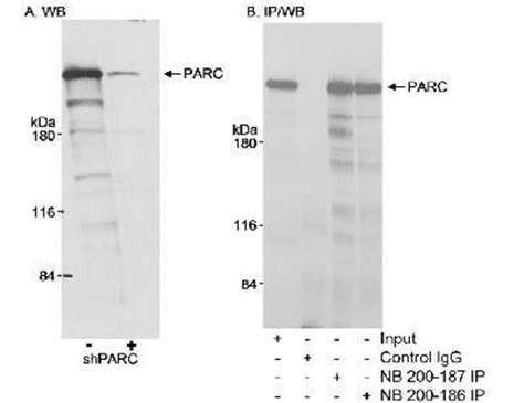 Parc Antibody Novus Biologicals 01ml Unlabeledantibodies