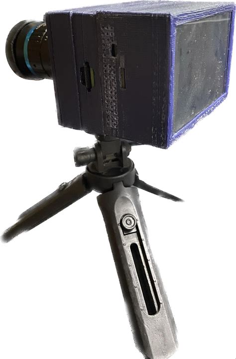 Leukocytoclastic Vasculitis Stage 23 Viral Hepatitis Bc Object