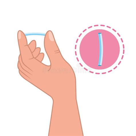 Contraceptive Implant Design Stock Illustration Illustration Of