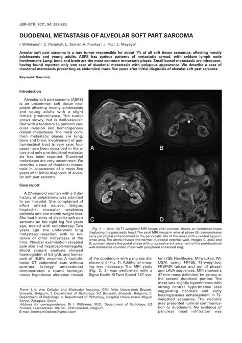 Pdf Duodenal Metastasis Of Alveolar Soft Part Sarcoma