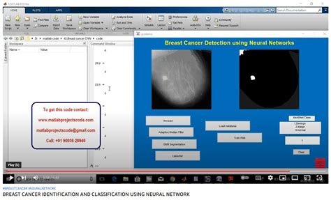 breast cancer identification and classification using neural network