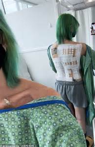 Woman 34 Who Is Allergic To Semen Lays Bare Brutal Toll The Condition