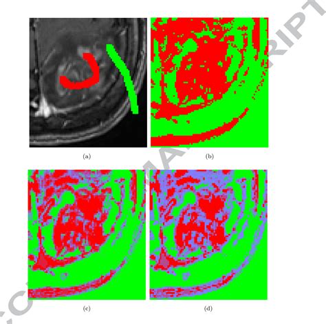 Figure From Integrating Machine Learning With Region Based Active Contour Models In Medical