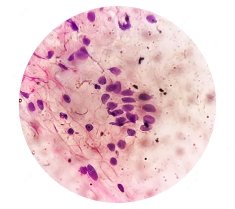Premium Photo Paps Smear Study Of A Young Women Under Microscopy