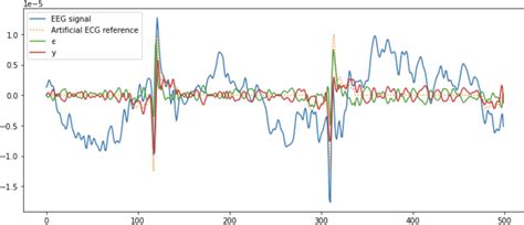 Ecg Adaptive Filtering Github