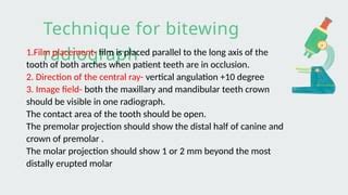Comprehensive Guide To Bitewing X Ray Procedure In Dentistry Pptx
