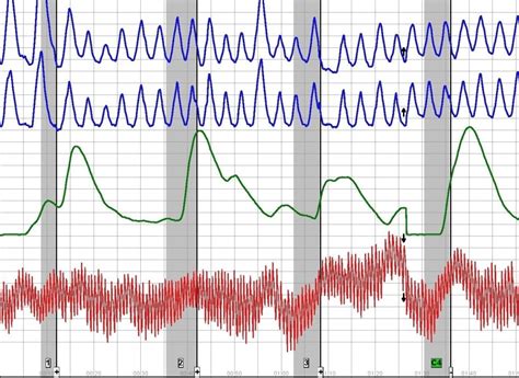 Polygraph Testing Schaad Detective Agency