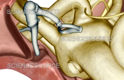 Auditory Ossicles
