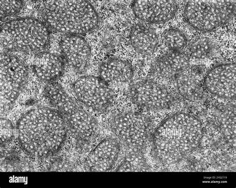 Transmission Electron Micrograph Tem Of Tubular Mitochondria In The