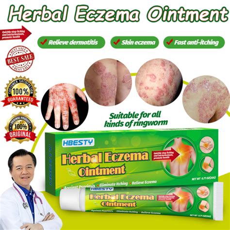 Gamot Sa Kati Kati Sa Balat Buni Ointment Atoderma Cream Original Eczema Treatment Cream
