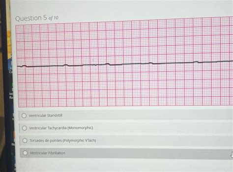 Question 5 Of 10 Ventricular Standstill Ventricular Tachycardia Monomorp