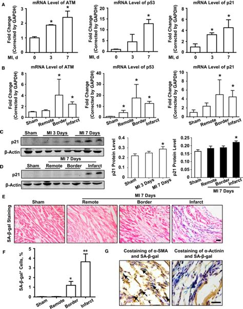 Haplodeficiency Of Ataxia Telangiectasia Mutated Accelerates Heart