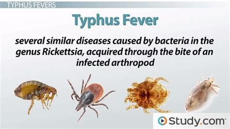 Epidemic Typhus The 1847 Typhus Epidemic In Canada — The