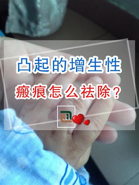 凸起的增生性瘢痕怎么祛除？ 知乎