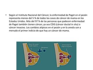 Anatomía De Mamappt
