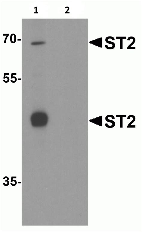 Anti St2 Antibody Bsa Free Ab25877 Abcam