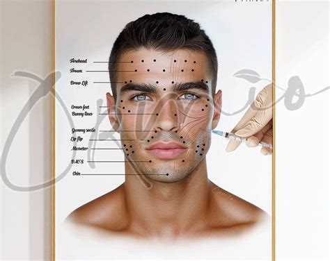 Botox Injection Points On Muscle Anatomy Botox And Filler Injector Anatomy Esthetician