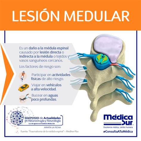 Médica Sur Las Fracturas Vertebrales Ocurren Cuando Los