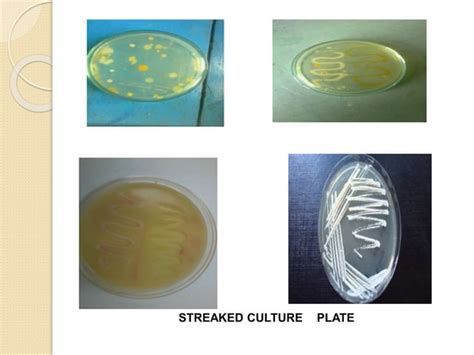 Isolation Of Protease Producing Microorganism Pptx Gardening Home