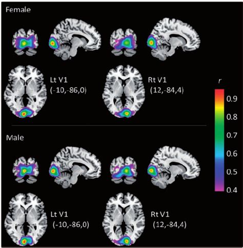 Functional Connectivity From V1 ROIs To Other Visual Areas In Each Sex Download Scientific