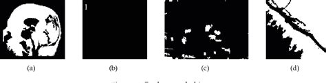 Figure 4 From Image Segmentation Using Gray Scale Morphology And Marker