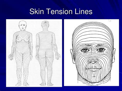 Langers Lines Foot