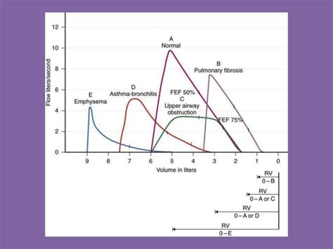 Pulmonary Flow Volume Loops Drpadmesh Pptx Lung And Respiratory