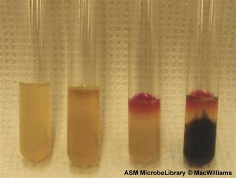 Sulfide Indole Motility Sim Medium Principle Procedure And Results