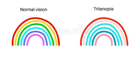 Tritanopia Stock Illustrations 74 Tritanopia Stock Illustrations Vectors And Clipart Dreamstime Tritanopia Stock Illustrations 74 Tritanopia Stock Illustrations Vectors And Clipart Dreamstime