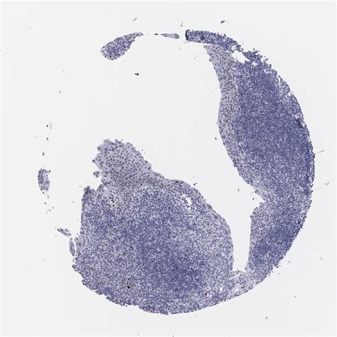 Tissue Expression Of Tp53 Staining In Tonsil The Human Protein Atlas
