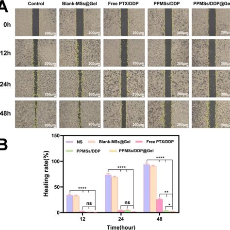 Preparation And Characterization Of Porous Pla Microsphere Optical