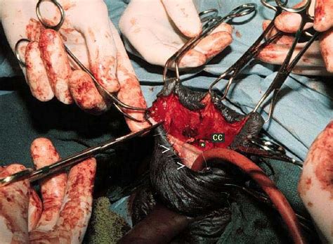 Penis Phallectomy 08 In Horses Equis Vetlexicon