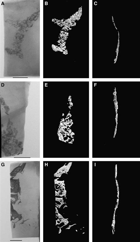Representative X Ray A D G And Microcomputed Tomography Images Download Scientific Diagram