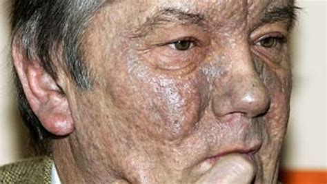 Wiktor Juschtschenko Der Wiedergeborene Ausland Faz