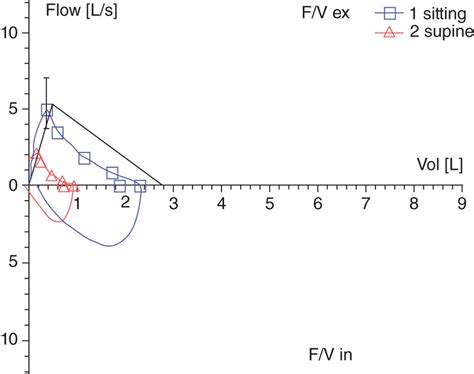 Positional Spirometry Sitting Flow Volume Loop Shown In Blue 1 And Download Scientific
