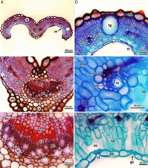 Photomicrographs Of The Leaf Trasnverse Sections Of Hypericum