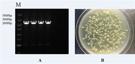 Pcr Amplification And Recombinant Plasmid Blue White Screening Map A