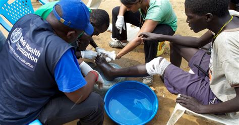 Dracunculiasis Guinea Worm Disease