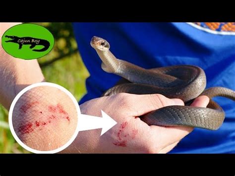 Is A Python Bite Poisonous