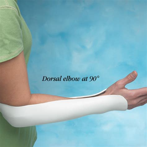 Sugar Tong Splint Ankle At Maria Baum Blog