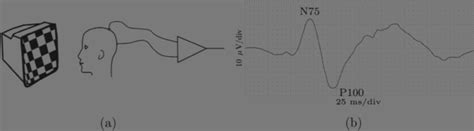 Visual Evoked Potentials A Recording Setup Using Pattern Reversal Download Scientific