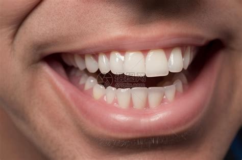 牙齿护理高清图片下载 正版图片 摄图网