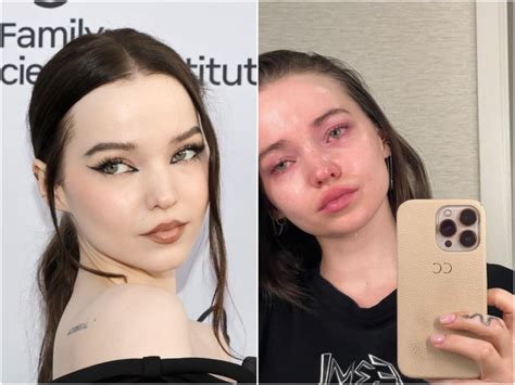Dove Cameron Shares Crying Selfies As She Details Struggle With