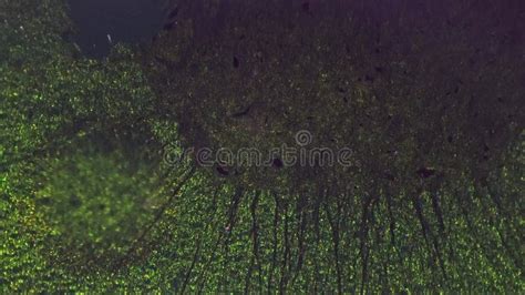 Spinal Cord In Transversal Section Magnified Under Microscope In 100