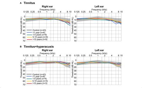 Hearing Sensitivity For Right Ear Left And Left Ear Right