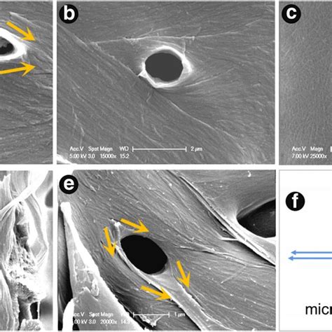 Microfibril Orientation Of Secondary Cell Walls In Parenchyma Cells
