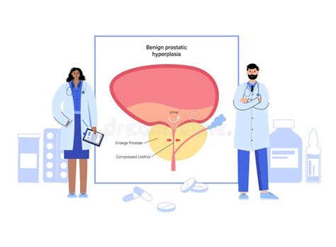 Man Reproducive System Problems Stock Illustration Illustration Of