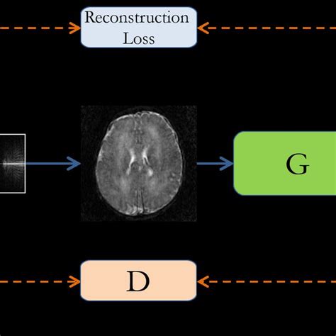 The Proposed Motion Correction Framework For Multishot Mri Where Cg