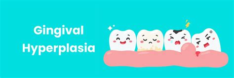 Gingival Hyperplasia Causes Symptoms And Treatments